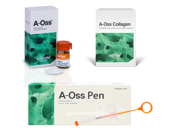 오스템, 이종골 이식재 'A-Oss' 인기 고공행진 - 치학신문